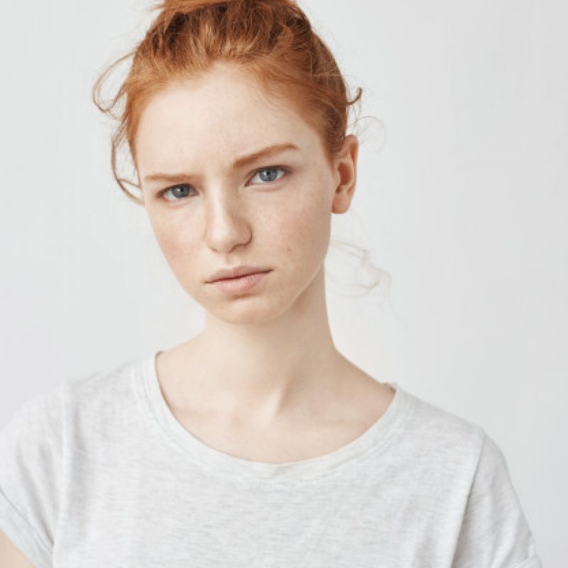 Flek, Freckles, dan Hiperpigmentasi Itu Berbeda, Simak Penjelasannya!